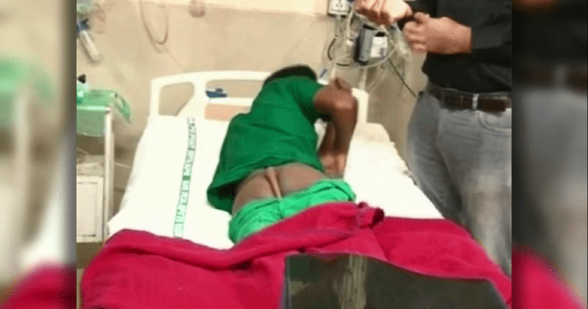 VIDEO: Indian teen has 8-inch tail - Loop News