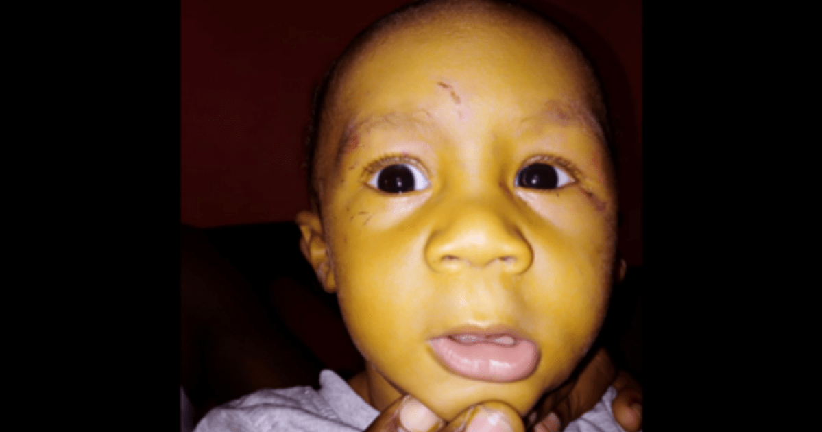 Baby beaten, bruised at daycare; mom seeks legal action - Loop News