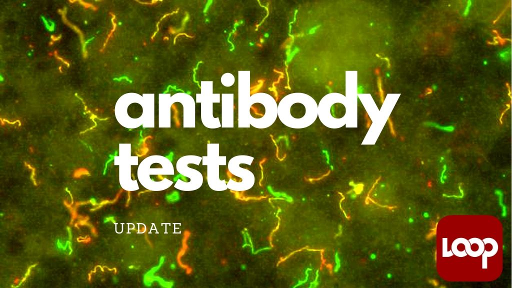 COVID-19: Interesting results in Cayman antibody tests - Loop News